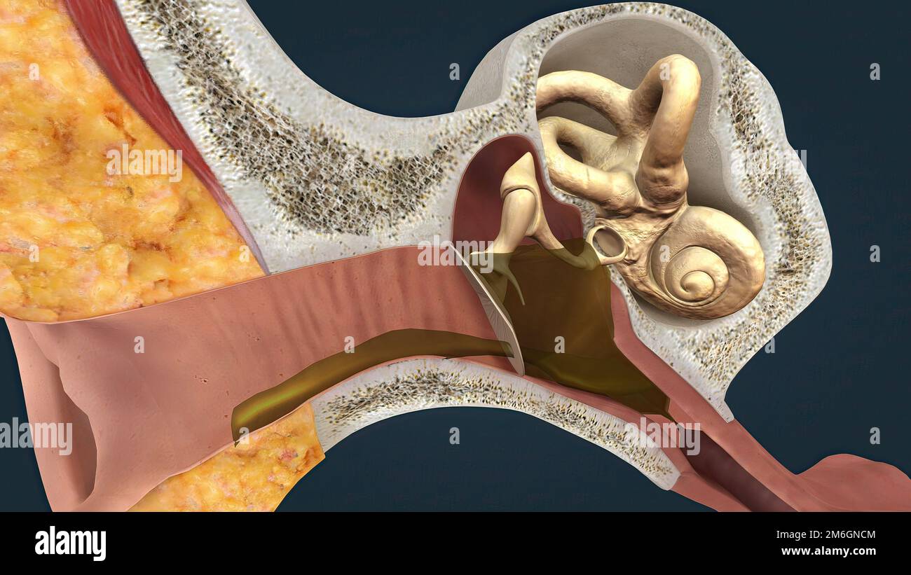 Inflammation behind the ear otitis hi-res stock photography and images ...