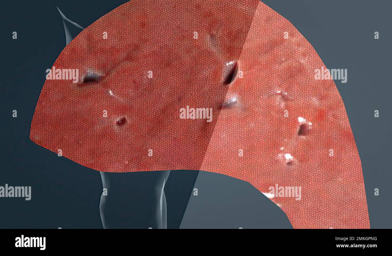 Abdominal level hi-res stock photography and images - Alamy