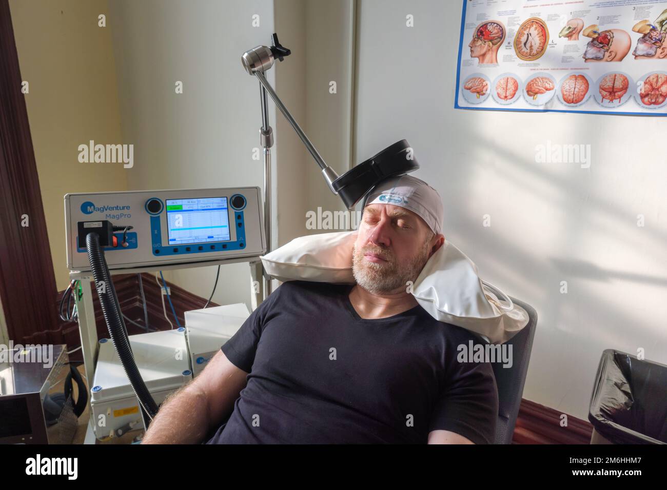 Montreal, CA - 15 november 2022: Patient undergoing Repetitive ...