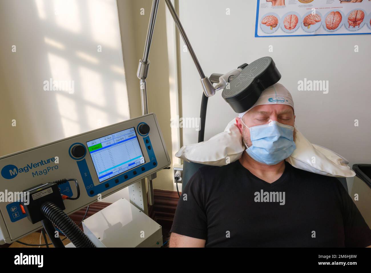 Montreal, CA - 15 november 2022: Patient undergoing Repetitive Transcranial Magnetic Stimulation ...