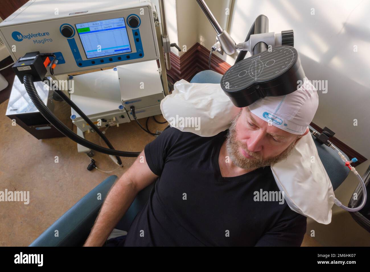 Montreal, CA - 12 november 2022: Patient undergoing Repetitive Transcranial Magnetic Stimulation ...