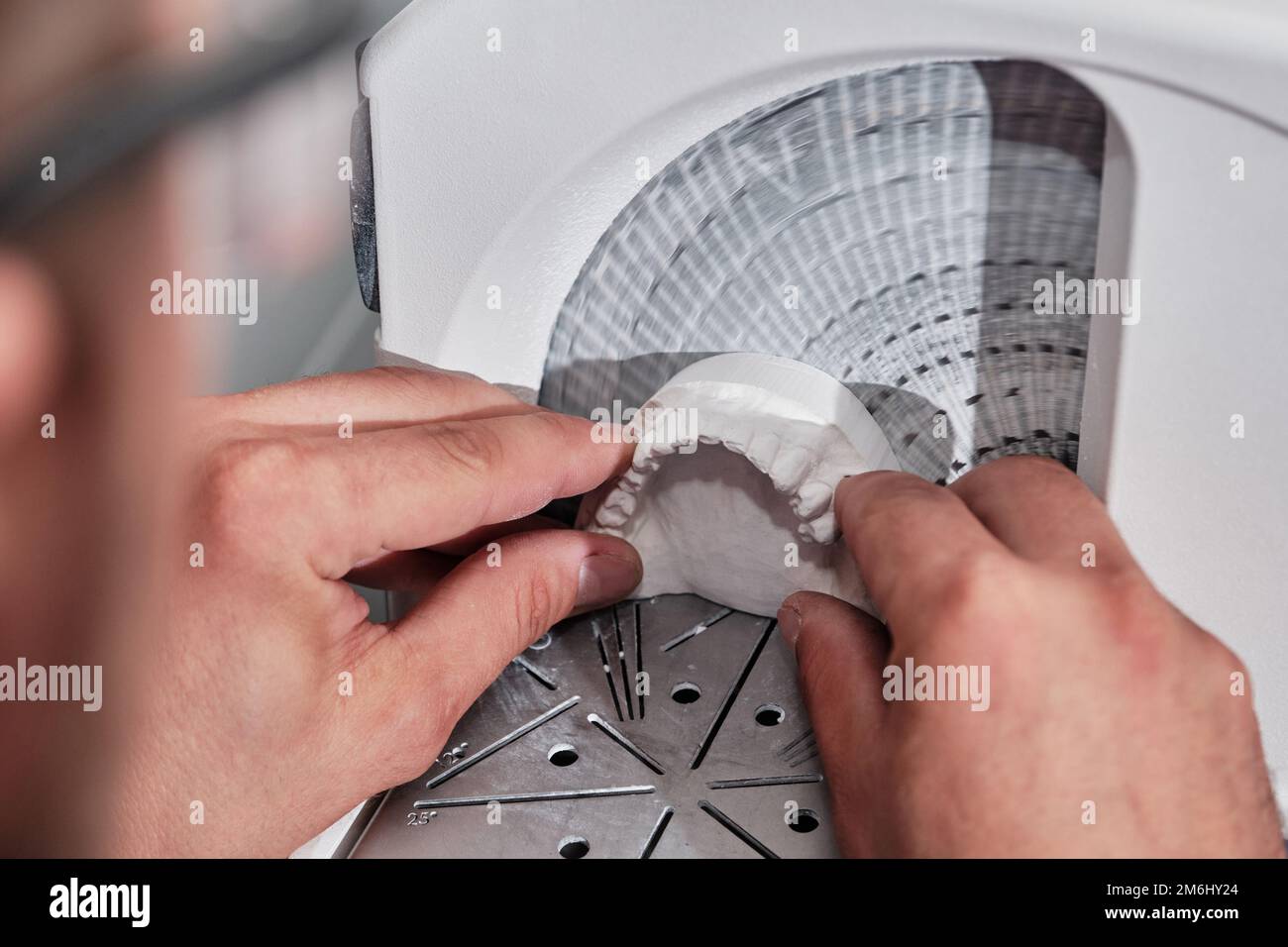 Dental technician trimming excess material from plaster models. Dental ...