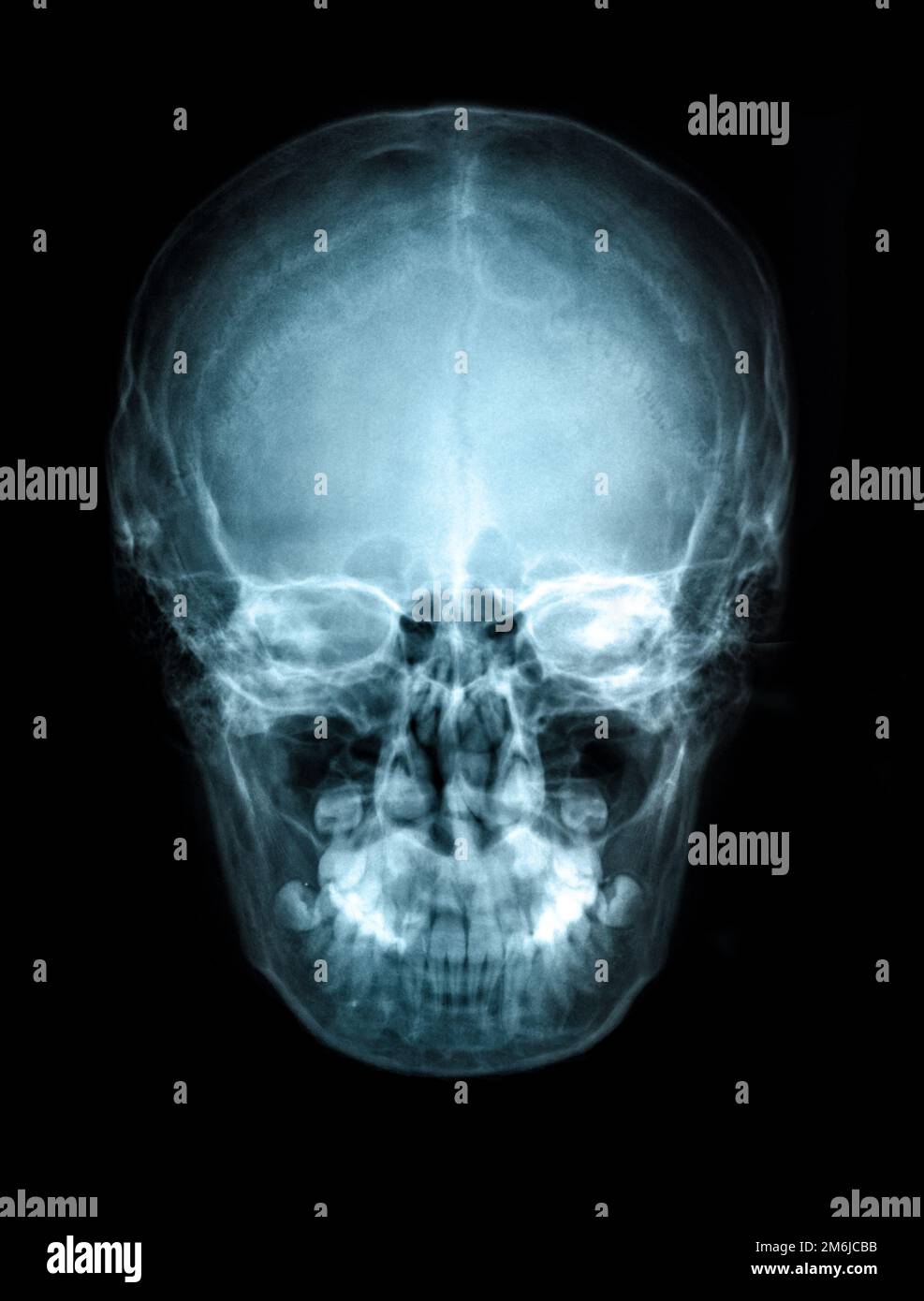 Human skull X-ray front view image film Stock Photo - Alamy