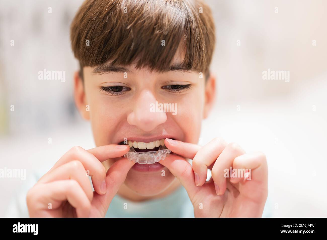 Teenager boy wear simulator orthodontic silicone invisible leveling ...