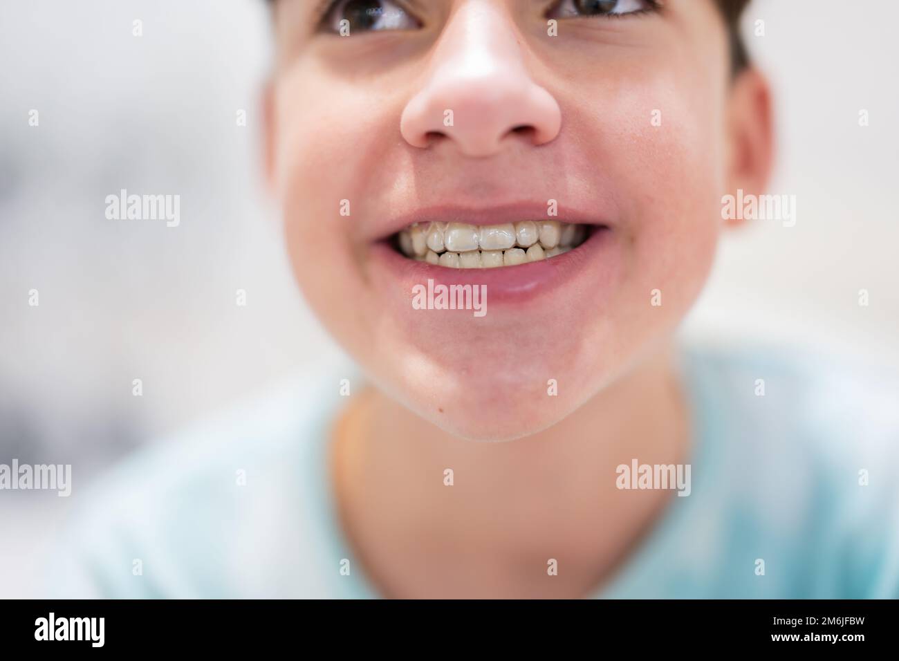 Teenager boy wear simulator orthodontic silicone invisible leveling ...