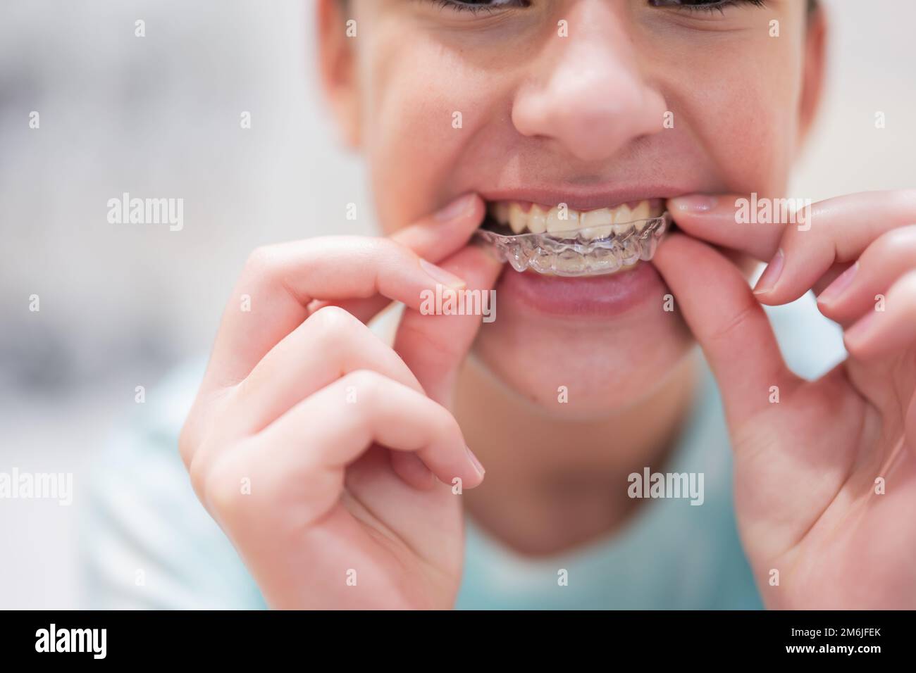 Teenager boy wear simulator orthodontic silicone invisible leveling ...