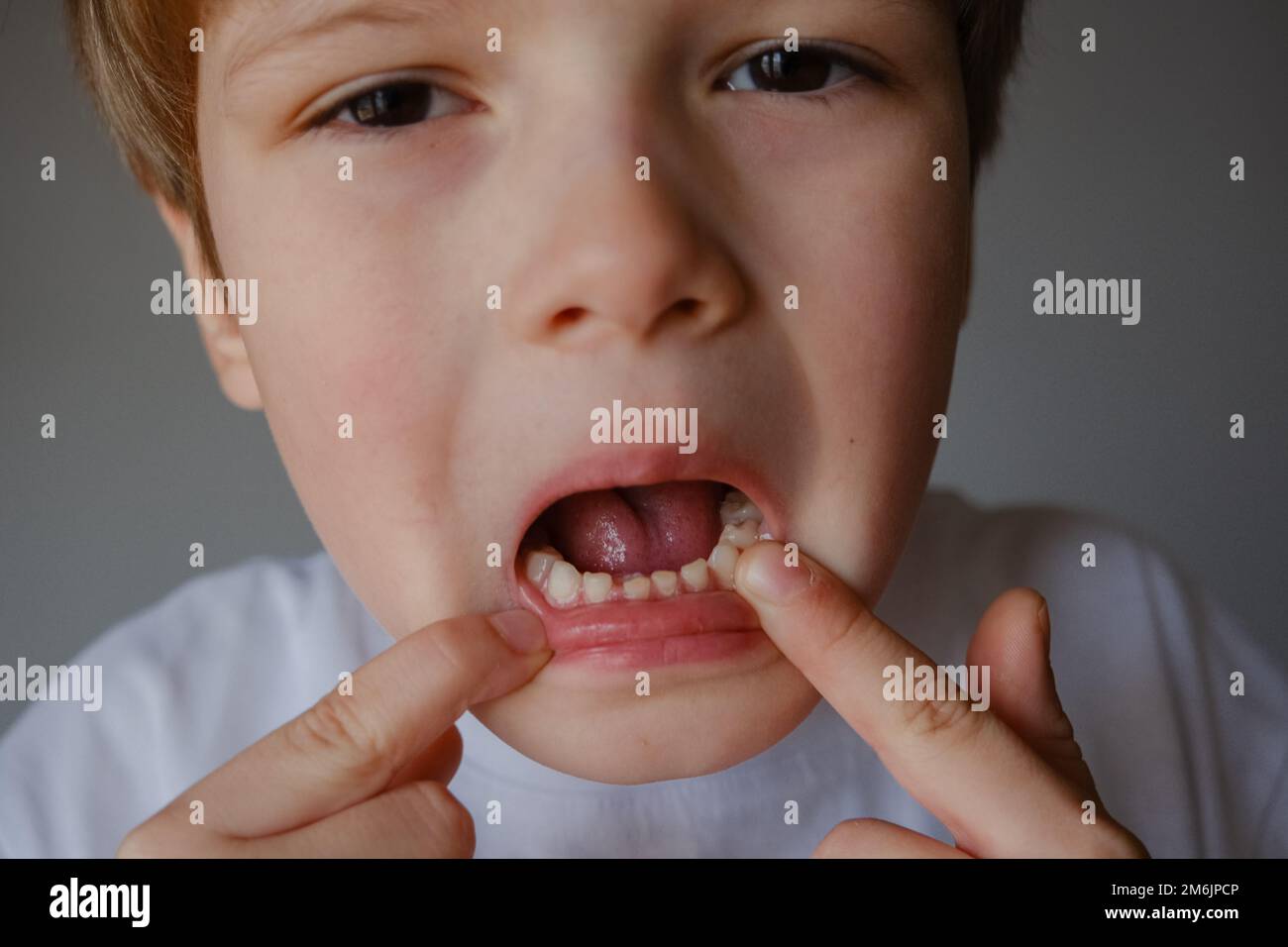 Closeup portrait of a kid showing his milk teeth, two rows Stock Photo ...