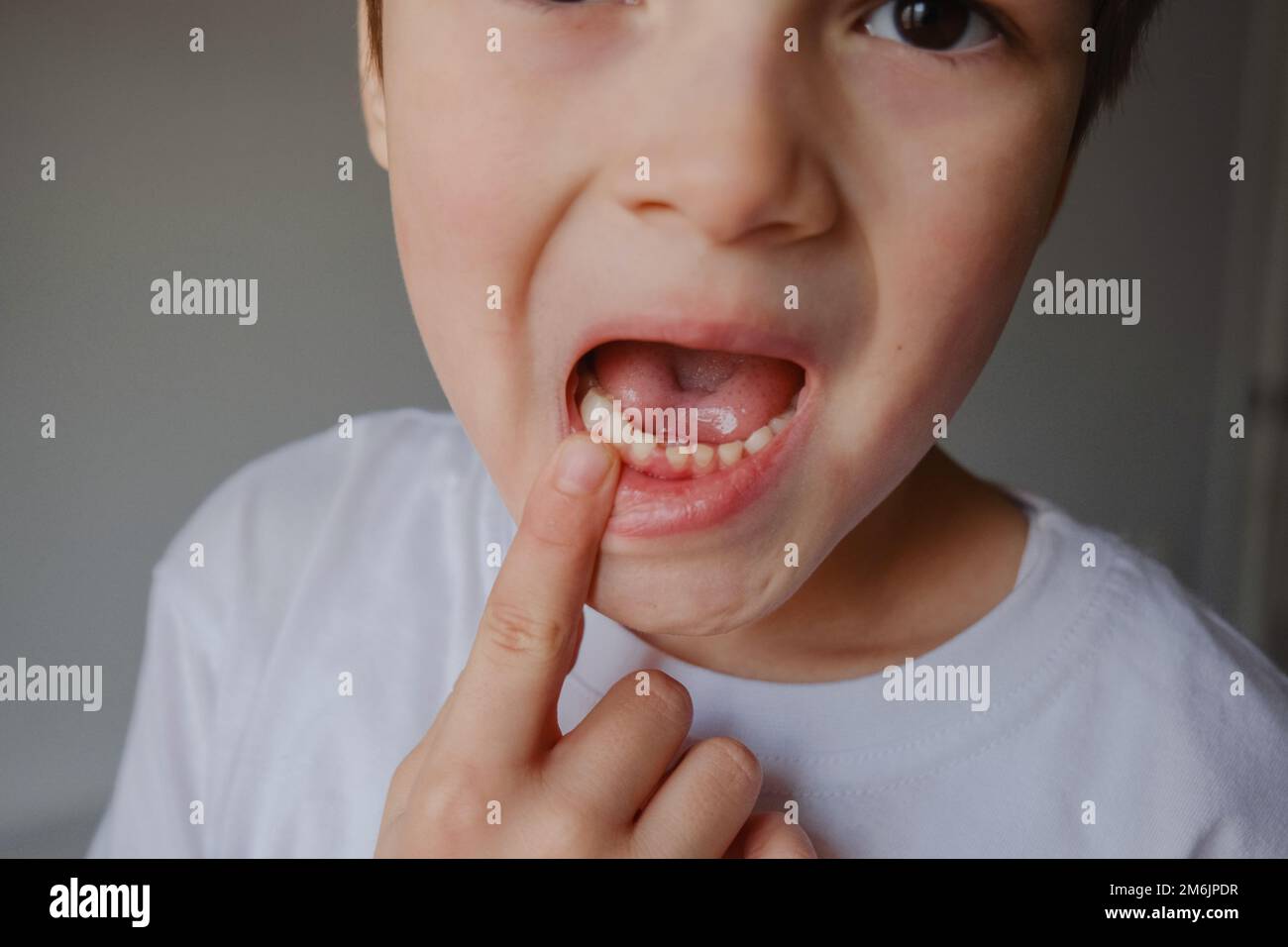 Closeup portrait of a kid showing his milk teeth, two rows Stock Photo ...