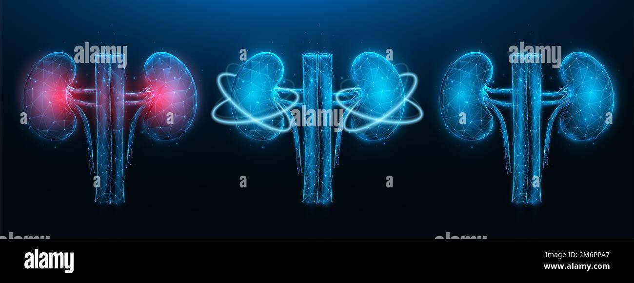 Polygonal vector illustration of inflamed diseased kidney, healthy ...
