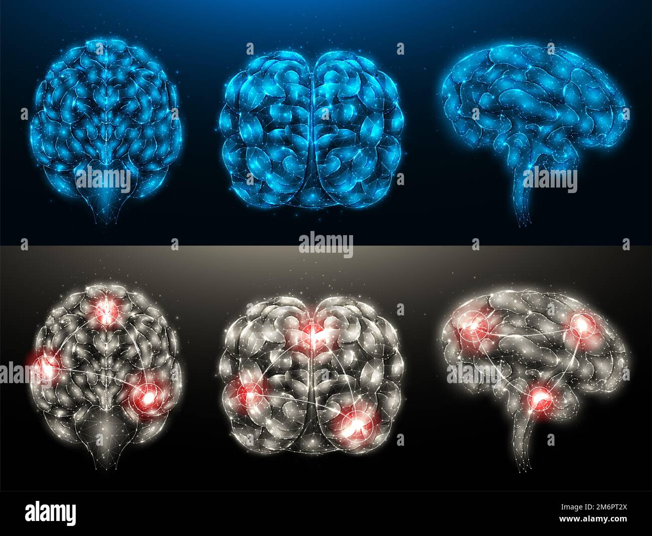 Set of polygonal vector illustrations of a healthy brain and a diseased ...