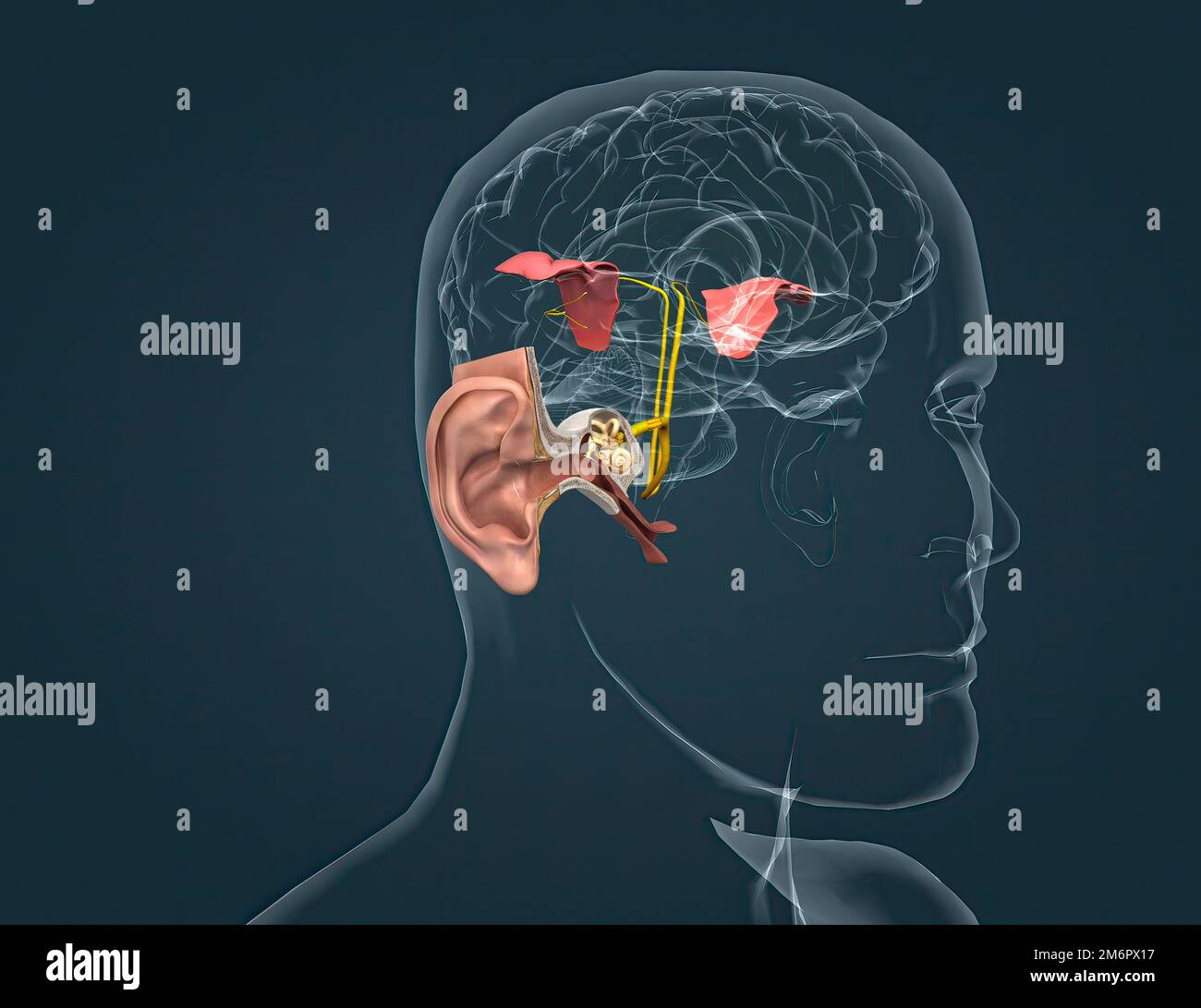 Paracentesis of the eardrum hi-res stock photography and images - Alamy