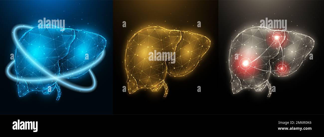 Polygonal vector illustration of inflamed diseased human liver, healthy ...