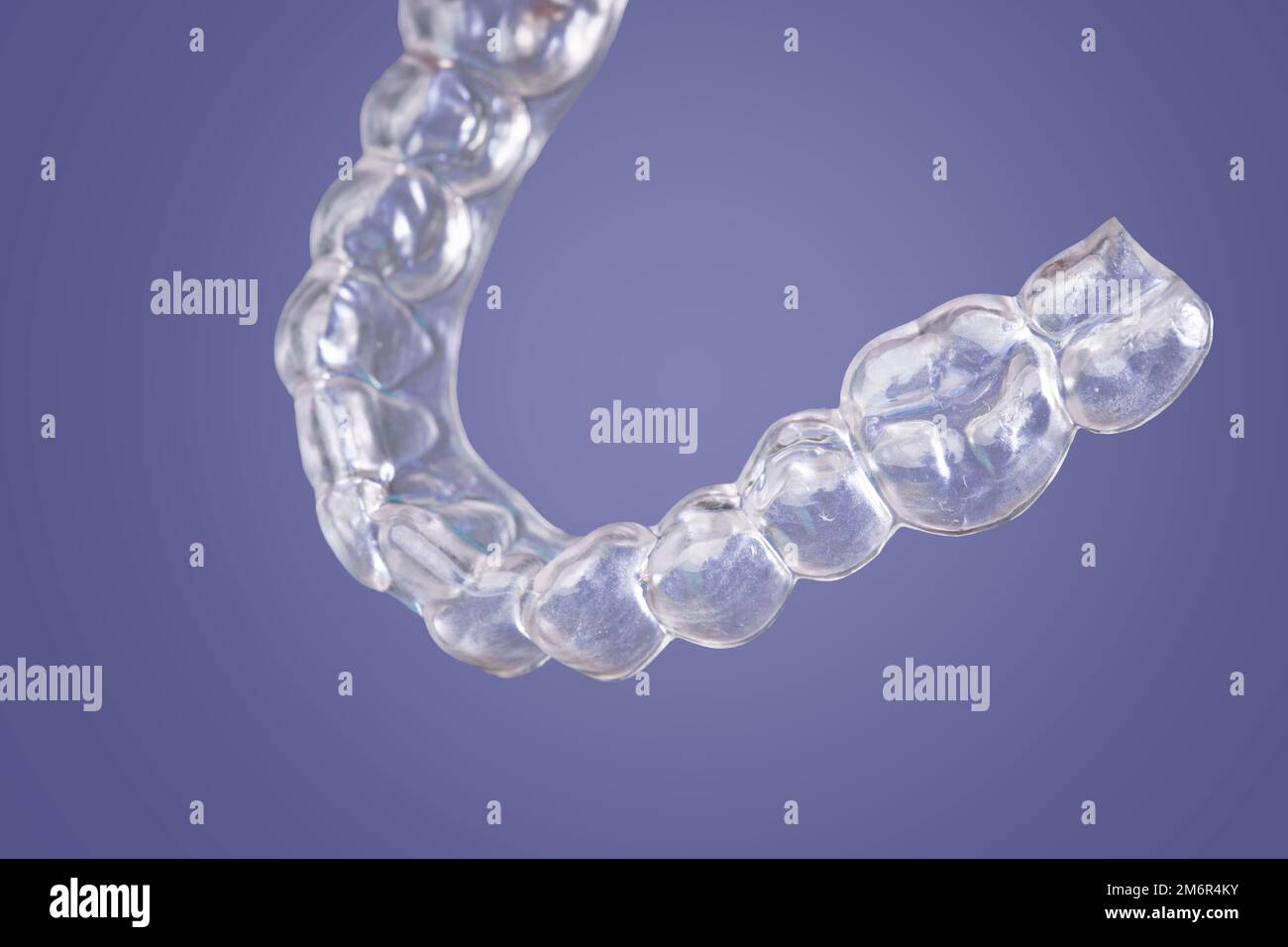 orthodontic treatment, invisible braces, new orthodontic technology ...
