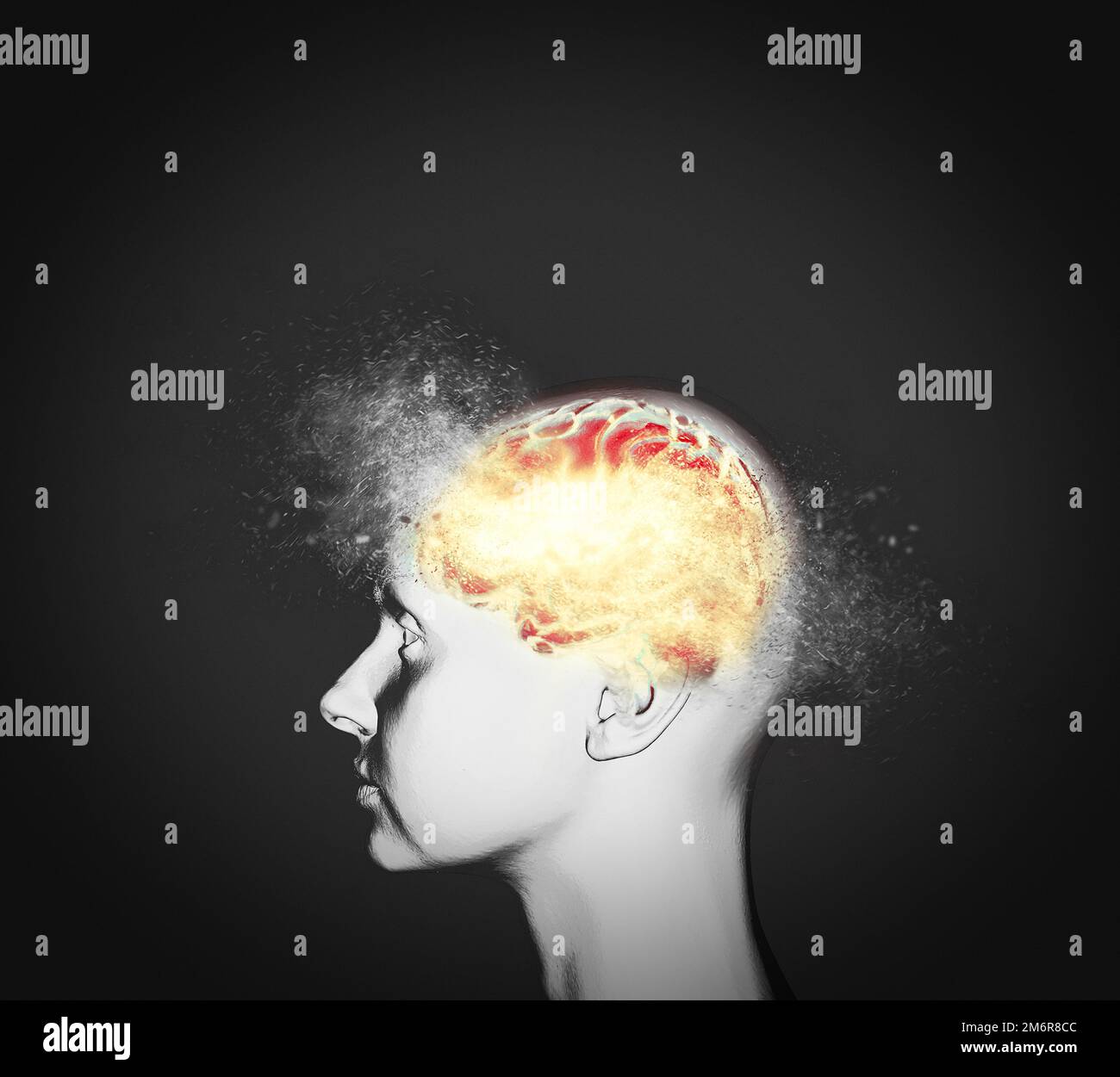 Memory lapses, forgetting things, degenerative disease. Brain problems ...