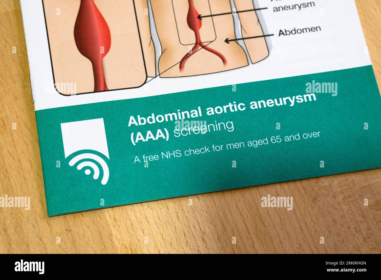 Abdominal aortic aneurism hi-res stock photography and images - Alamy
