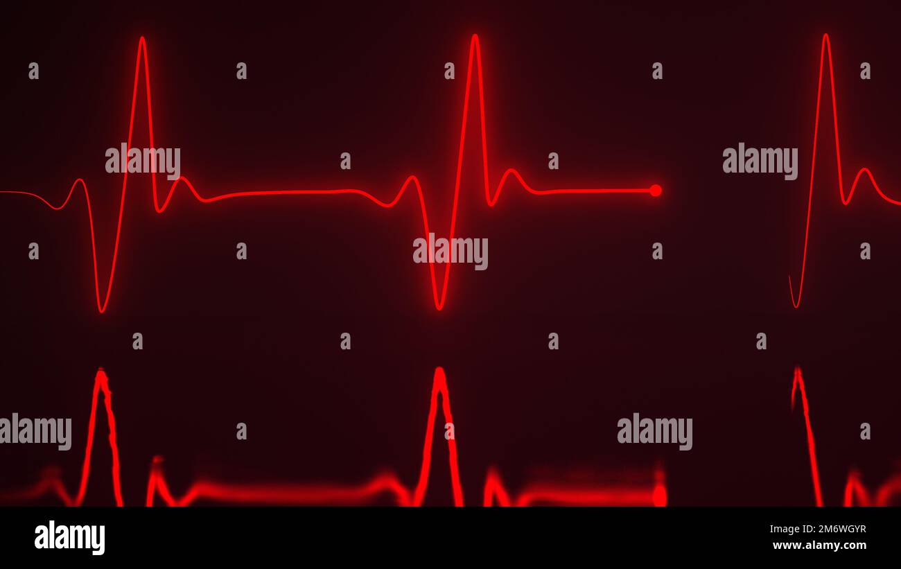 Cardiac stress curve hi-res stock photography and images - Alamy