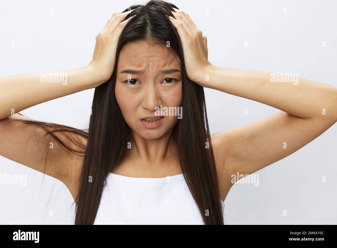 Asian woman facial skin problems, acne and inflammation, red rashes and ...