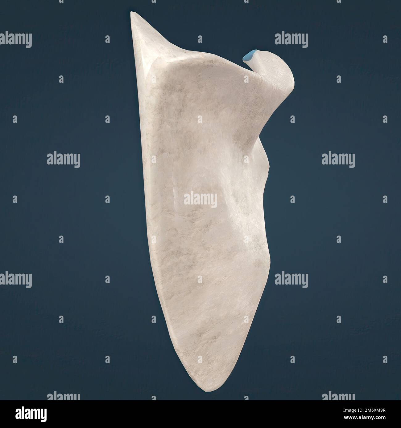 Scapula bone fracture hi-res stock photography and images - Alamy