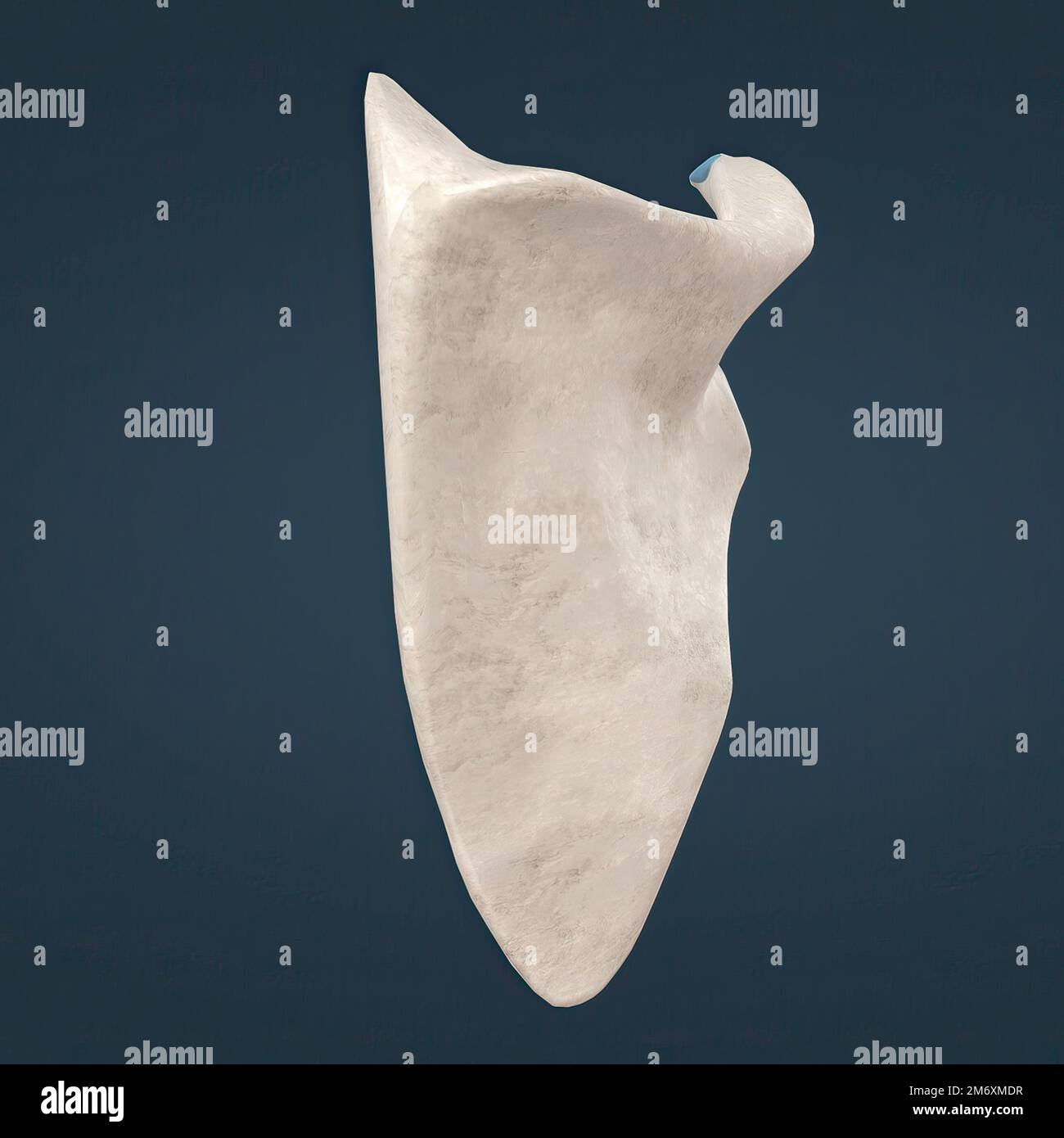 Scapula bone fracture hi-res stock photography and images - Alamy