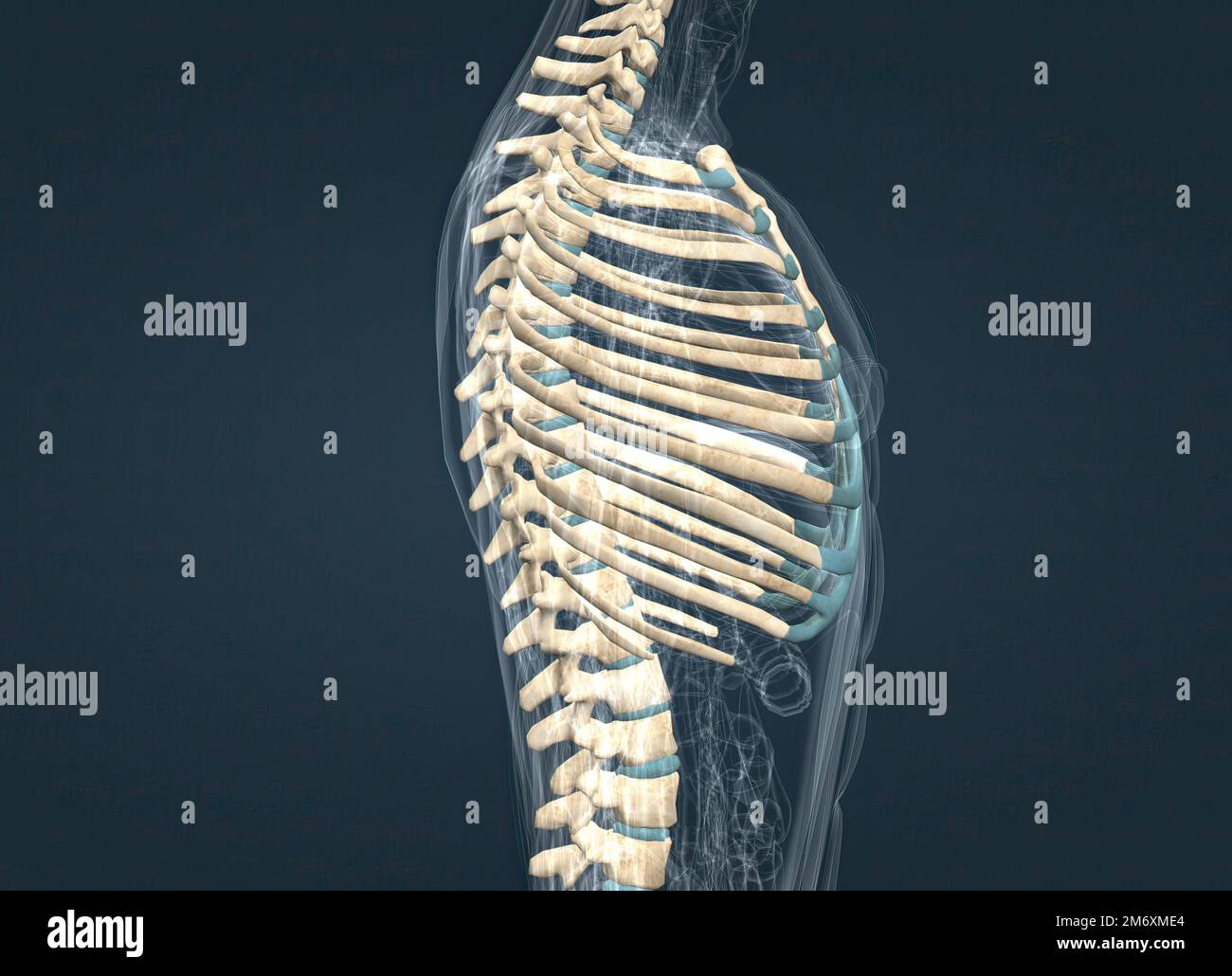 Rib fracture hi-res stock photography and images - Alamy