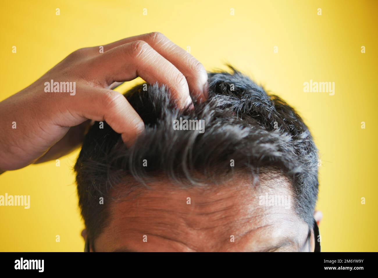 young men Scratching Head Against black background Stock Photo - Alamy