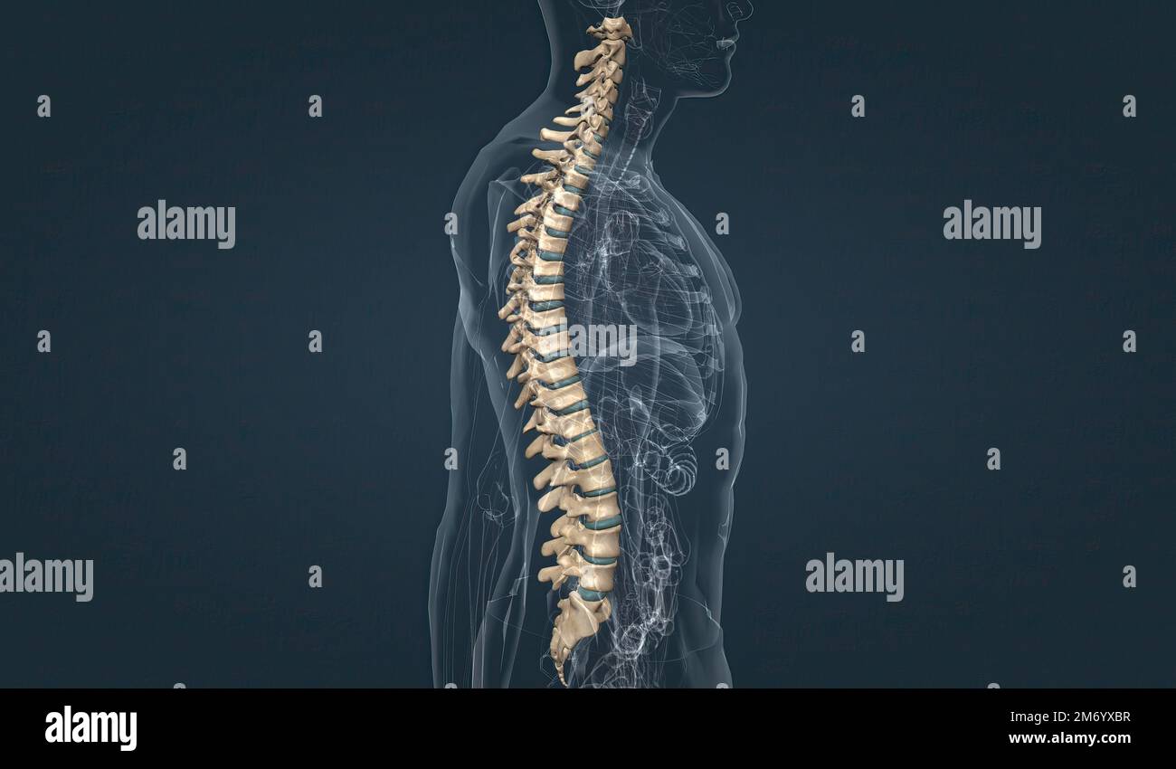 Fused vertebrae hi-res stock photography and images - Alamy
