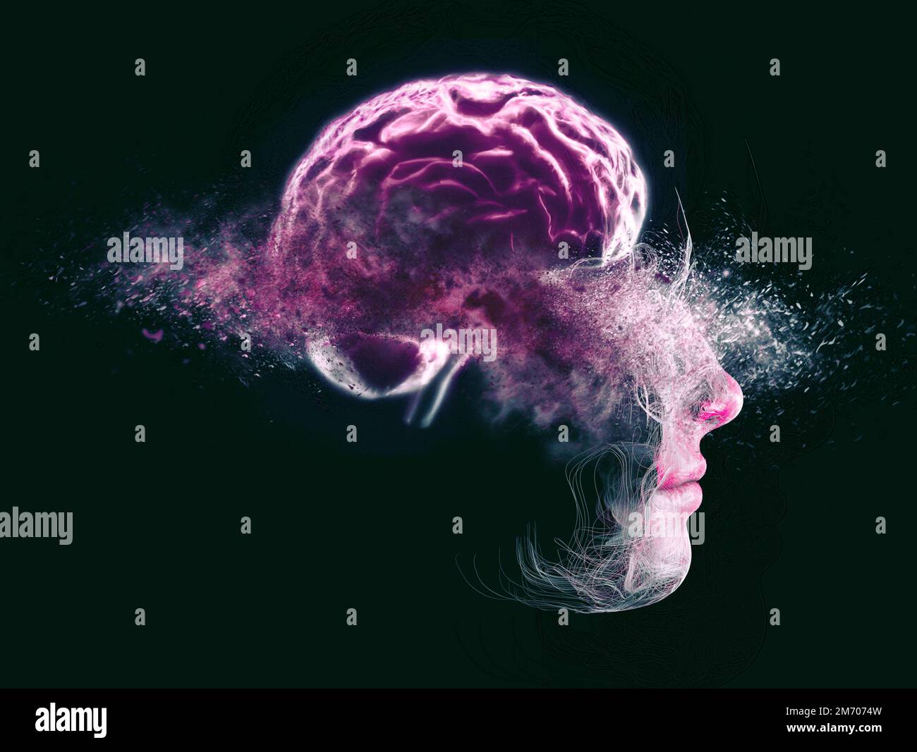 Memory lapses, forgetting things, degenerative disease. Brain problems ...