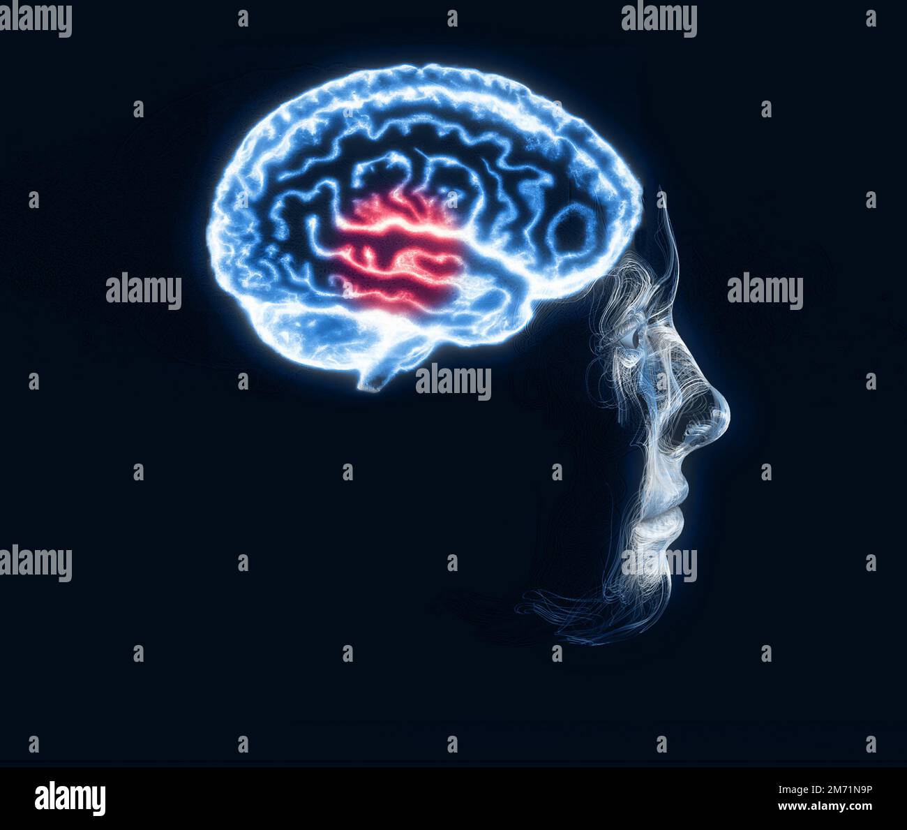 Memory lapses, forgetting things, degenerative disease. Brain problems ...