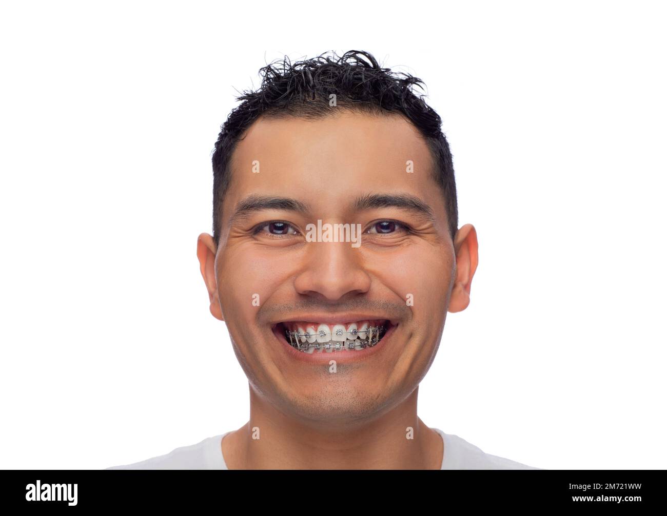 face of a young Latino man with dark skin smiles at the camera, shows ...