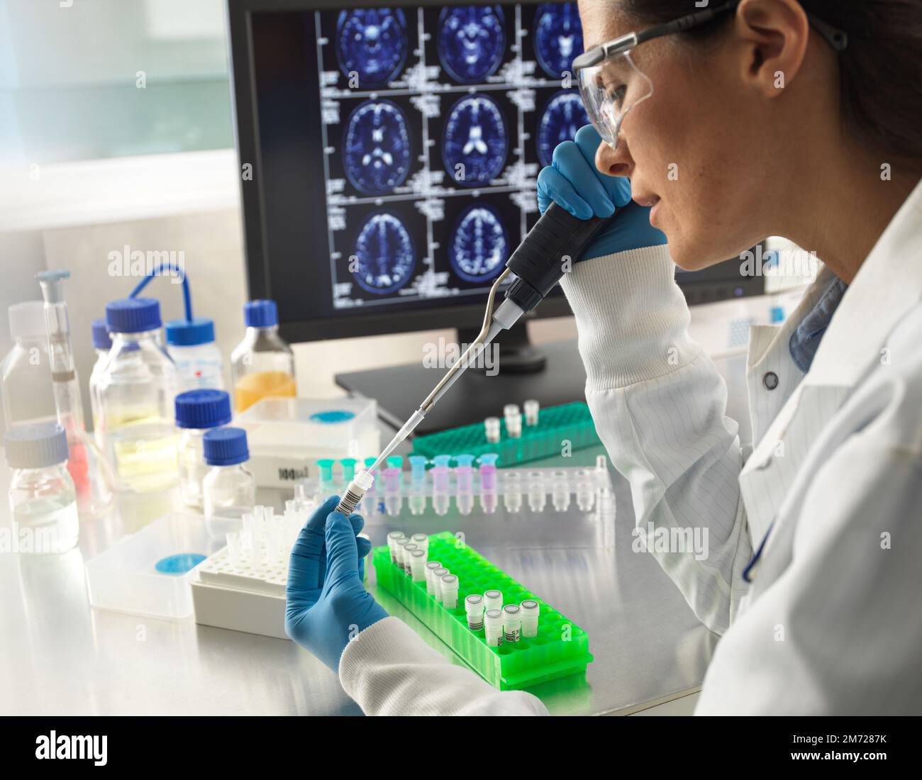 Alzheimer's and dementia research Stock Photo - Alamy
