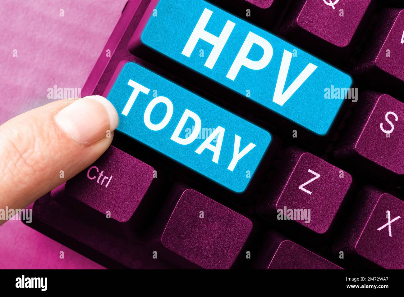 Inspiration showing sign Hpv. Conceptual photo Group of viruses that ...