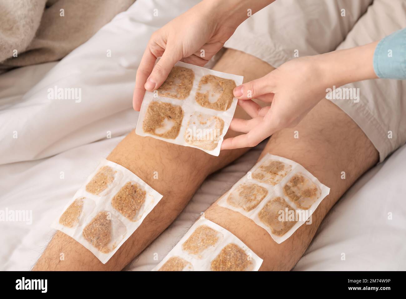 Female leg in plaster hi-res stock photography and images - Alamy