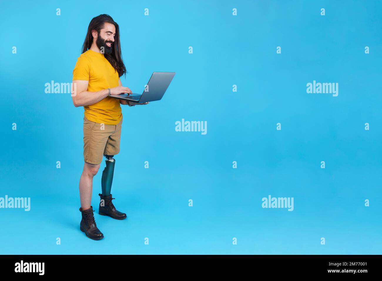 Smiley man with prosthetic leg standing using a laptop Stock Photo - Alamy