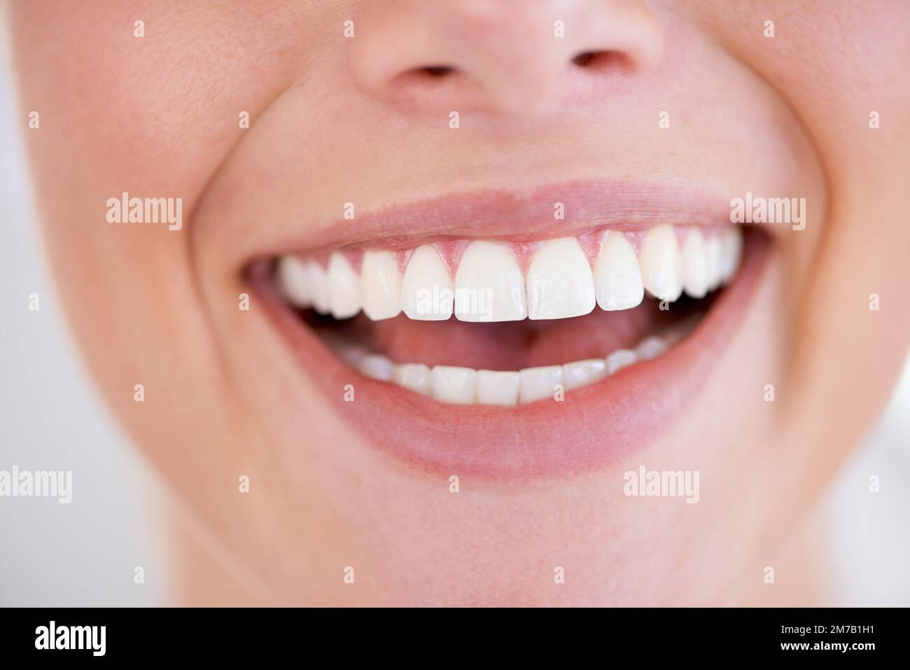 Sparkling teeth hi-res stock photography and images - Alamy