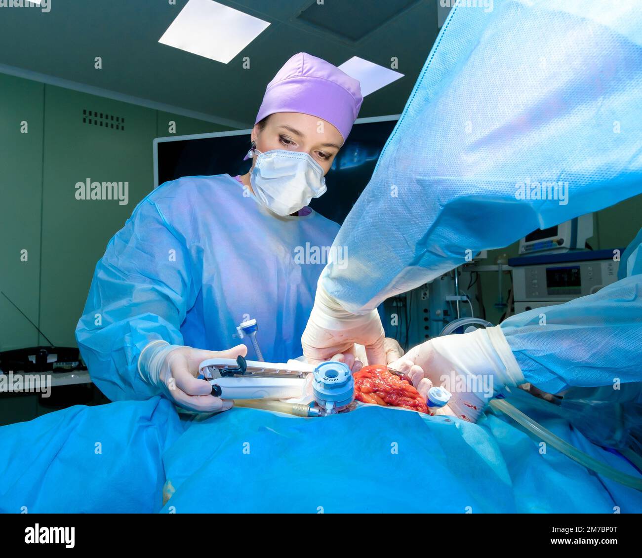 A female surgeon sews up the patient's internal organs with a stapler ...