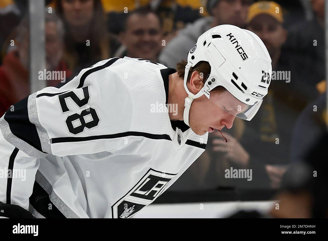 Los Angeles Kings' Jaret Anderson-Dolan spits out blood after being ...