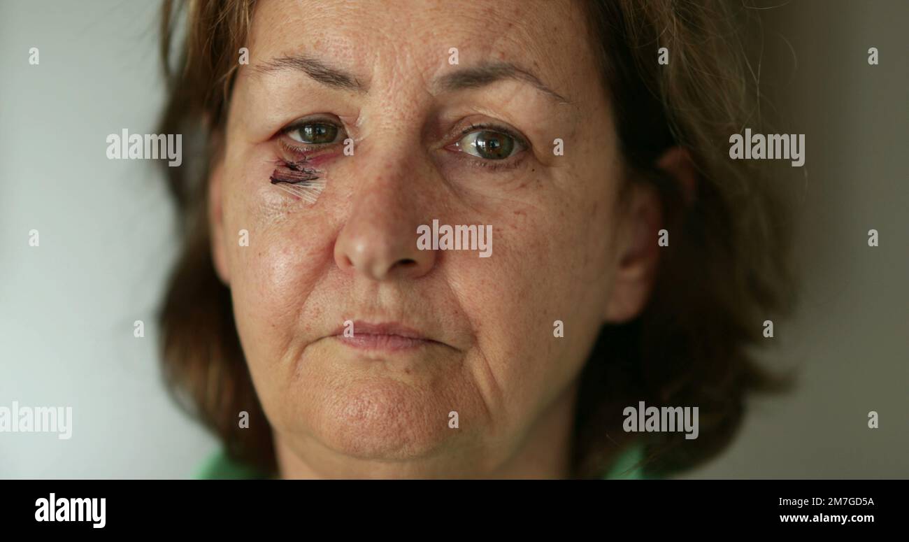 Older woman with beaten face and with scar shaking head with ...