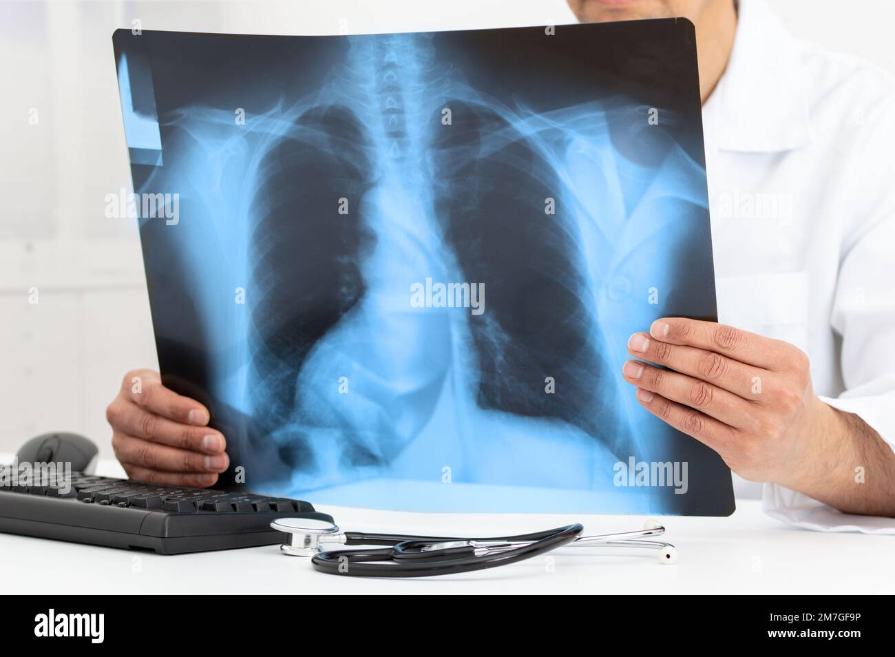 Man Doctor Looking at X-Ray Radiography in patient's Room with lung ...