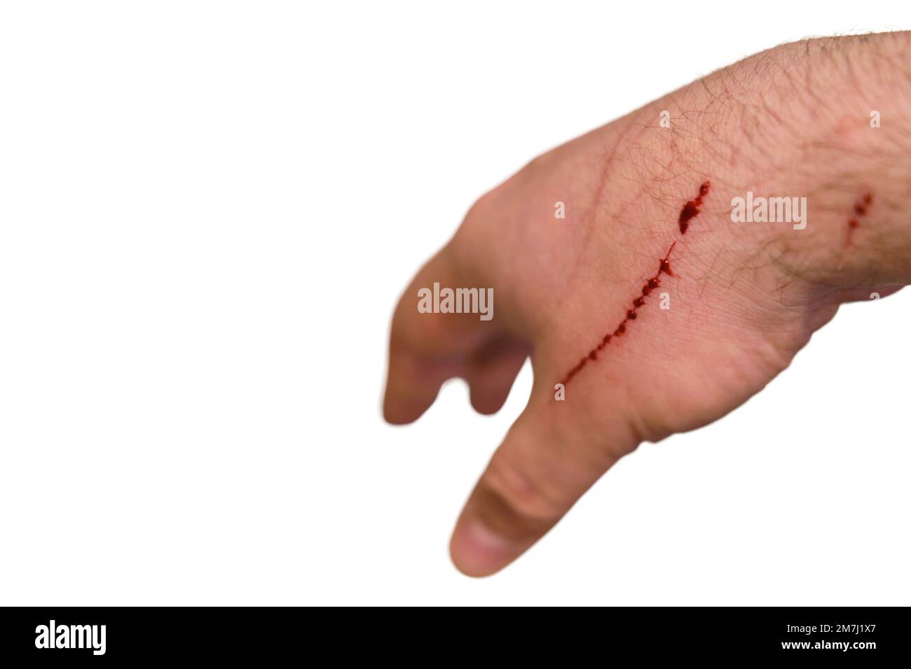 Cat bite wound Cut Out Stock Images & Pictures - Alamy