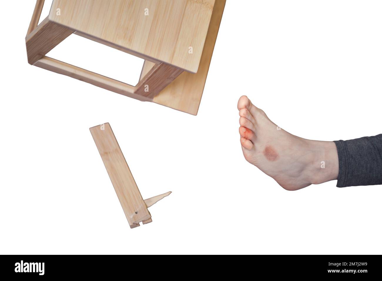 Woman injured foot on leg after falling from wooden stepladder ...