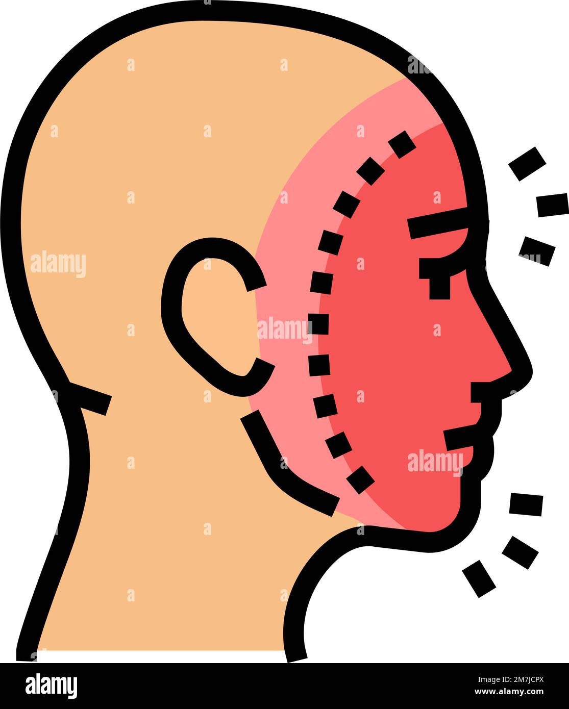 Medical illustration man face muscle Cut Out Stock Images & Pictures ...