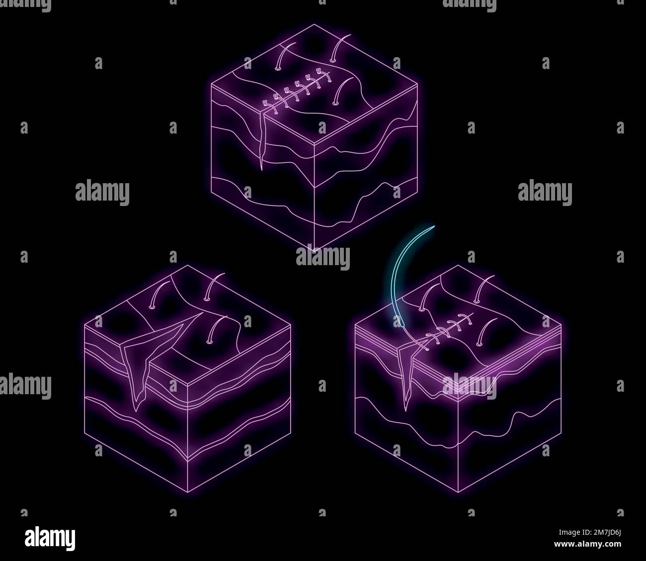 Surgical suture icons set. Isometric set of surgical suture vector ...