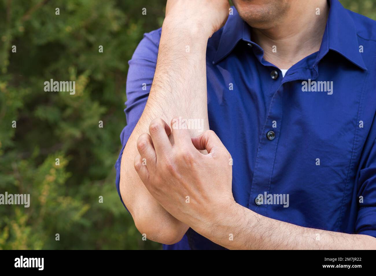 Close-up of man scratching arm because it stings in a park with a green ...