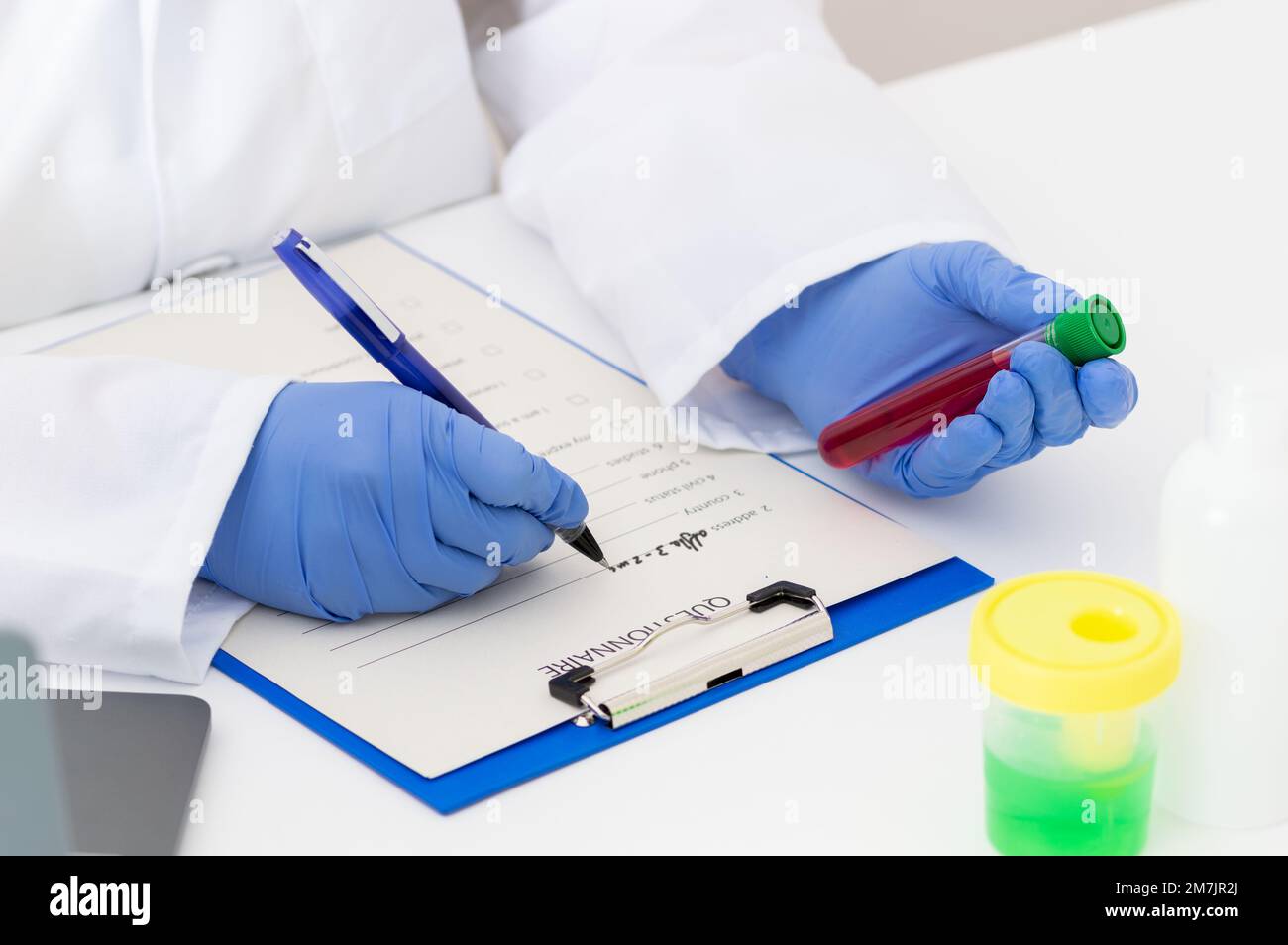 Closeup shot of a scientist examining a blood sample and recording ...