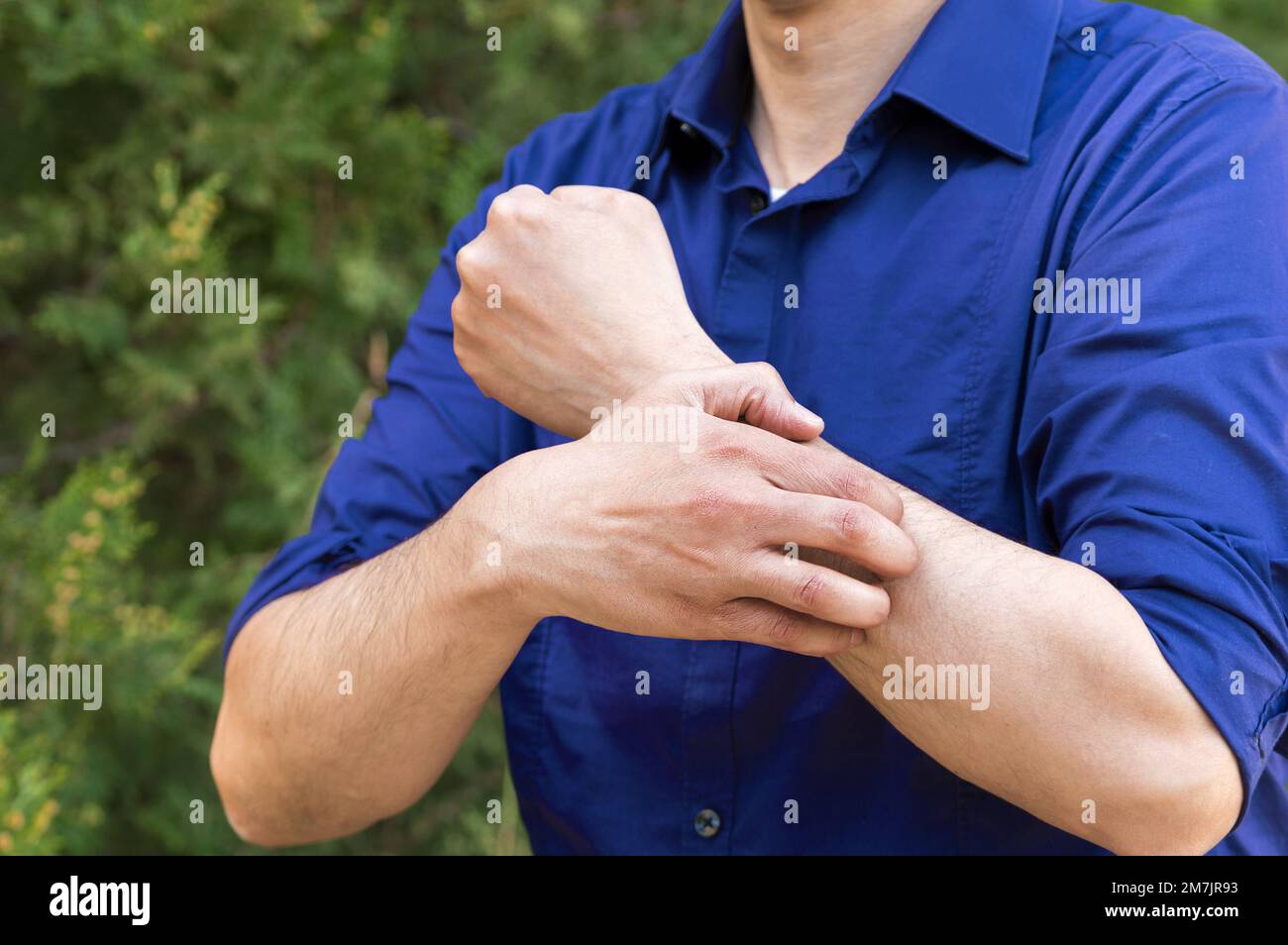 Scratching one arm hi-res stock photography and images - Alamy