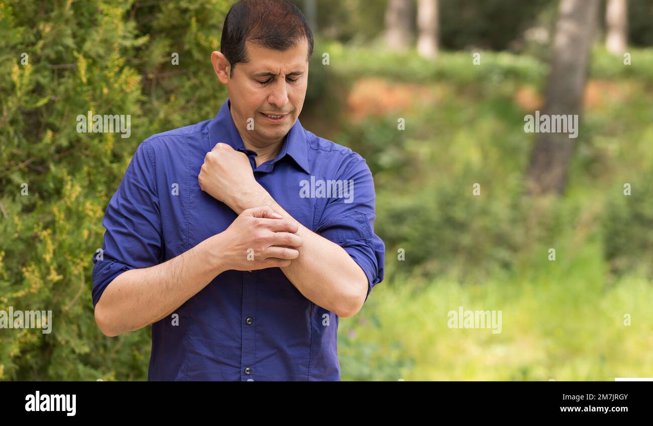 Man scratching arm because it stings in a park with copy space Stock ...
