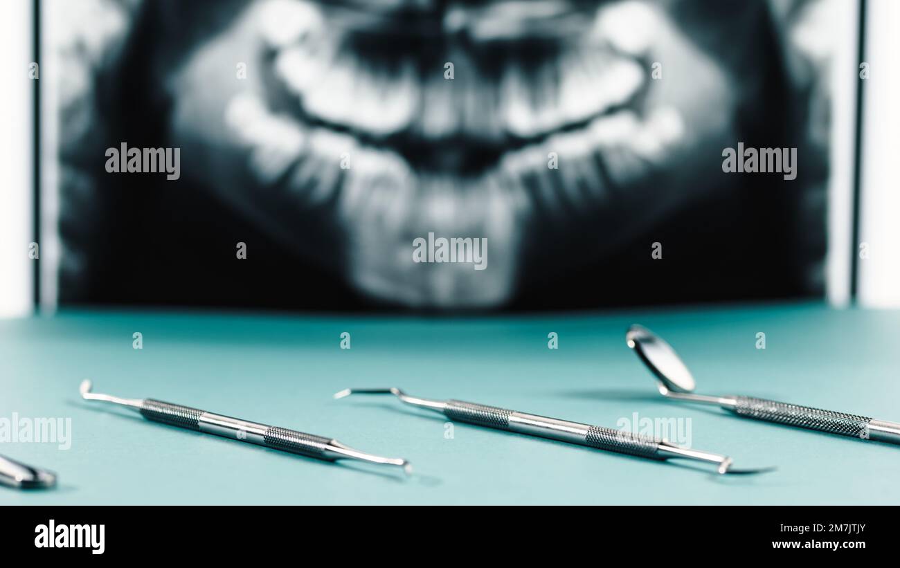 Dentist tools and teeth in x-ray Stock Photo - Alamy