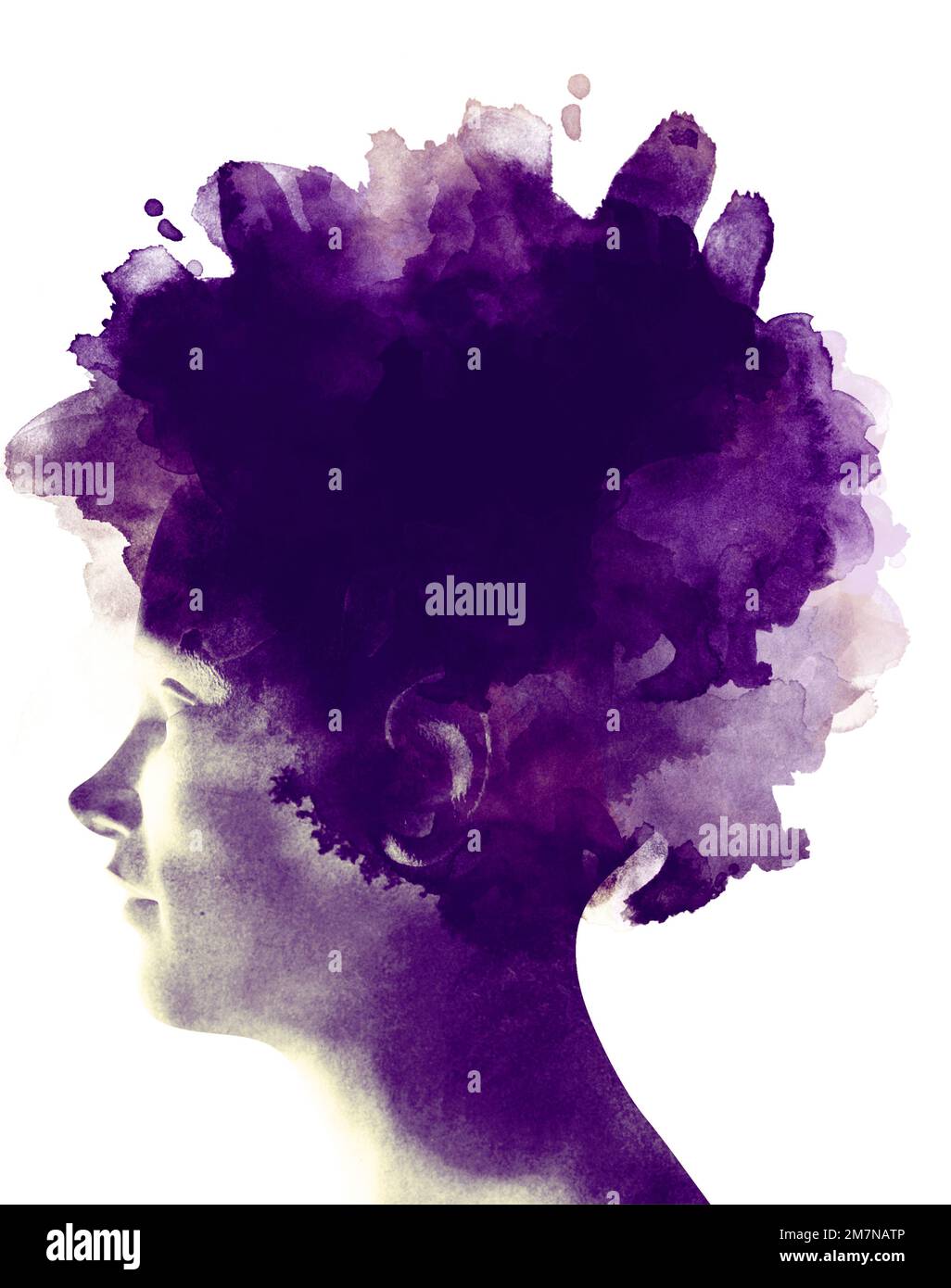 Face seen from the side. Brain problems. Degenerative disease. Bipolar ...