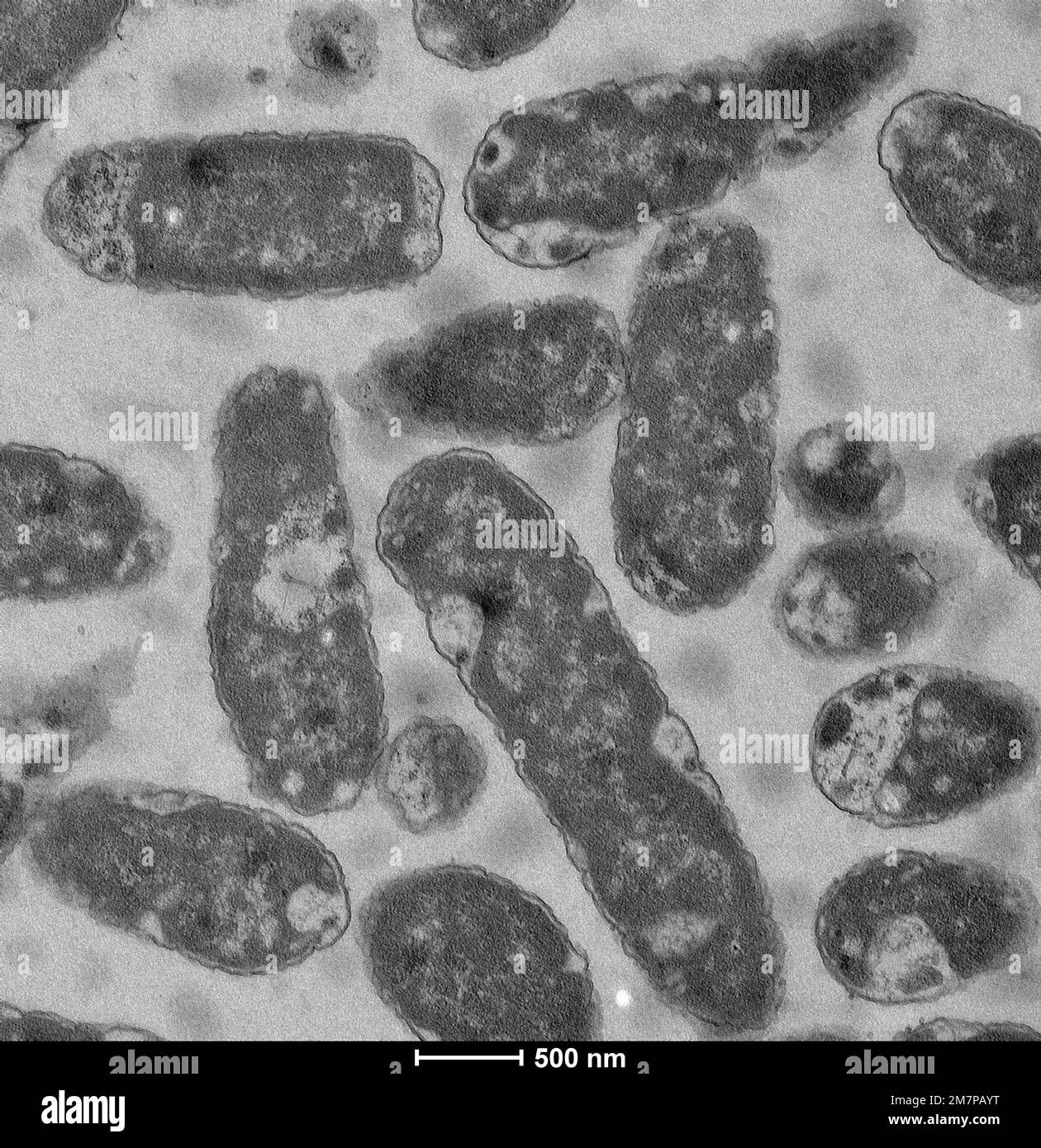 Escherichia coli (E.coli) under Transmission electron microscopy (TEM ... Escherichia coli (E.coli) under Transmission electron microscopy (TEM ...