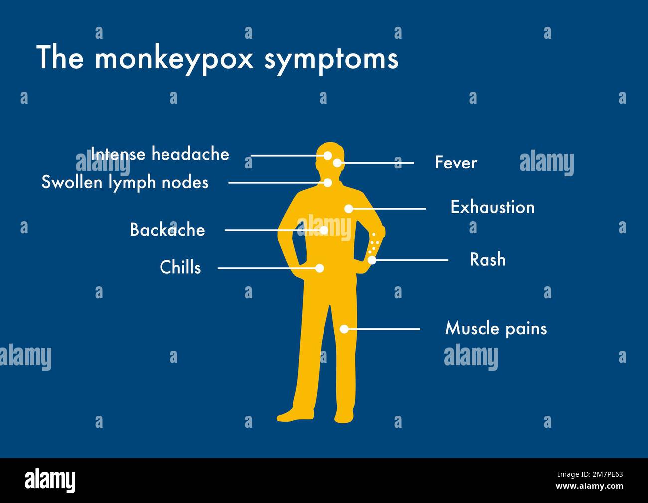 The main symptoms of monkeypox disease Stock Photo - Alamy